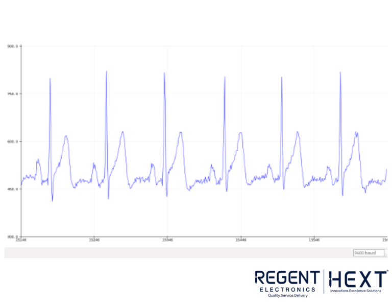 AD8232 Heart Rate Monitor: A Detailed Guide with Arduino Interfacing ...